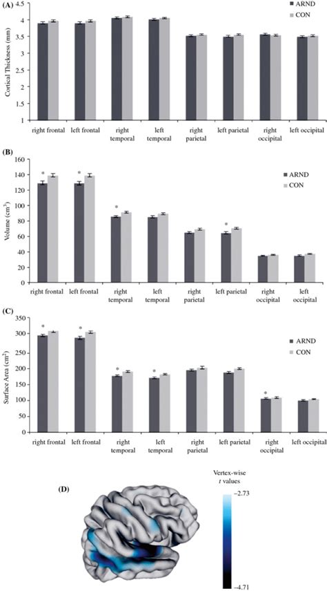 A Nonsignificant Group Differences In Mean Lobar Cortical Thickness Download Scientific