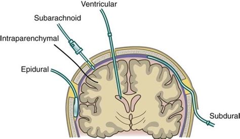 Increased Intracranial Pressure Iicp Flashcards Quizlet