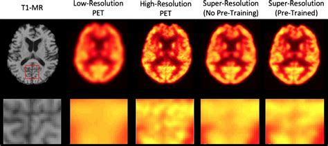 Deep Learning Based Spatial Resolution Enhancement Using Unpaired Download Scientific Diagram