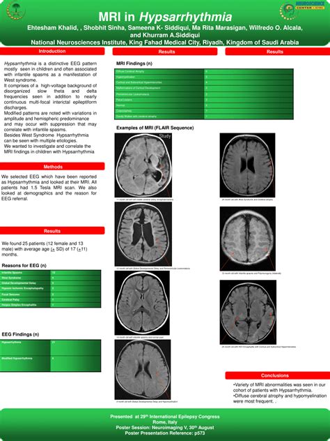 Pdf Mri In Hypsarrhythmia