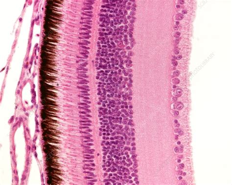 Layers Of The Retina Light Micrograph Stock Image C047 7805 Science Photo Library