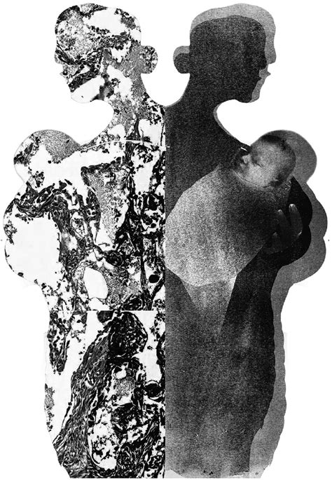 Minimally Invasive Autopsy Mia Also Called Minimally Invasive Tissue Download Scientific