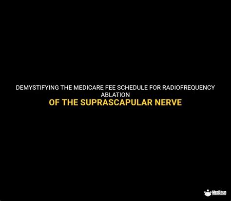 Demystifying The Medicare Fee Schedule For Radiofrequency Ablation Of