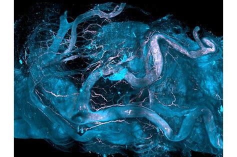 Novel Spatial Omics Technology Enables Investigation Of Diseases At Their Early Stages