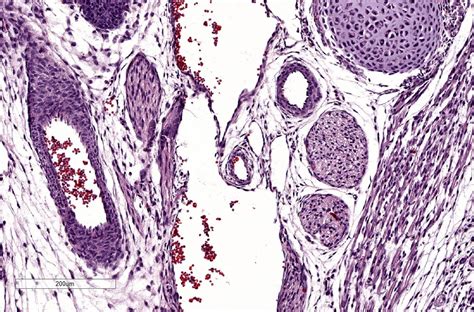 What Is Paraffin Wax In Histopathology At Gustavo Christensen Blog