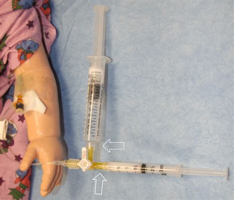 Example Of Intravenous Iv Administration Set Up On A Mannequin A Download Scientific Diagram
