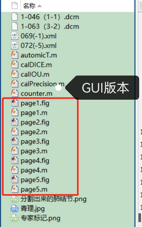 Matlab肺结节分割 肺结节提取 源程序，也有gui人机界面版本。 聚码科技