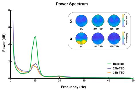 Brain Sciences Free Full Text Reduced Resting State Eeg Power Spectra And Functional