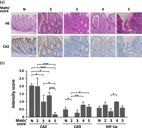 Carbonic Anhydrase 2 Ca2 Carbonic Anhydrase 9 Ca9 And Download Scientific Diagram
