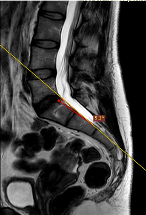 Figure 1 From Performance Of Fully Automated Algorithm Detecting Bone