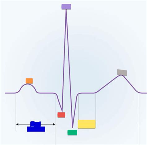 Lecture 18 Electorcardiogram Flashcards Quizlet