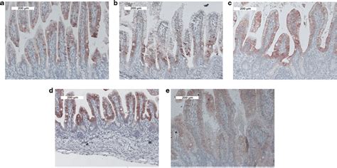 Localization Of I Fabp A Intestinal Fatty Acid Binding Protein Download Scientific Diagram