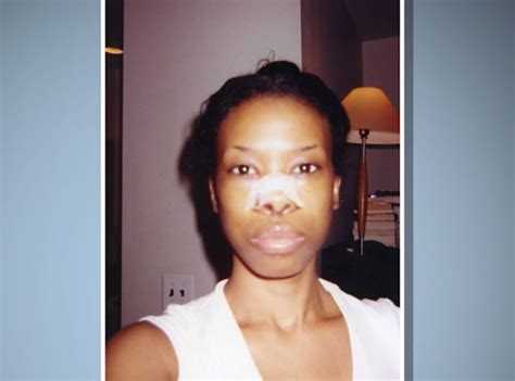 Botched Patient Reveals Doctor Operated On Her While She Was Awake