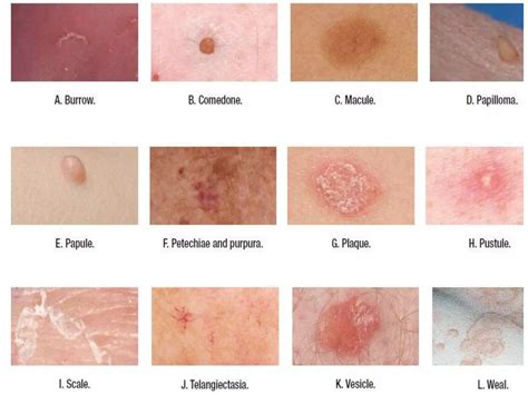 1 Skin Rash Pptx Infectious Diseases Diseases And Conditions