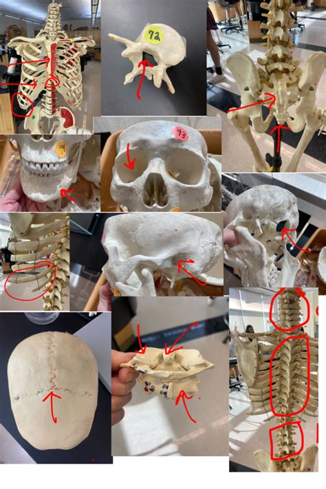 Axial Photos Quiz Diagram Quizlet
