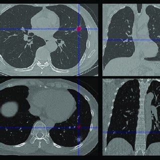 CT Images With Discordant Interpretations Between Deep Learning Models Download Scientific