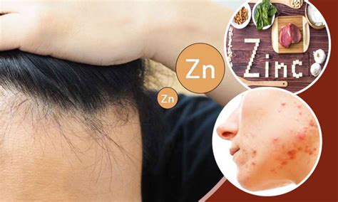 Zinc Deficiency Skin