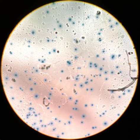 Microbiologygram™ On Instagram “mycoplasma Colonies With Fried Egg