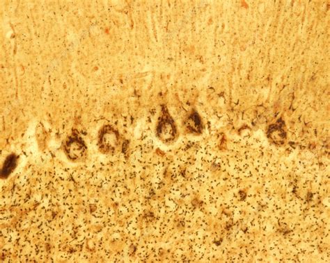 Cerebellar Cortex Light Micrograph Stock Image C0597793 Science Photo Library