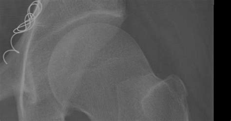 Re Strange Metal String Imgur