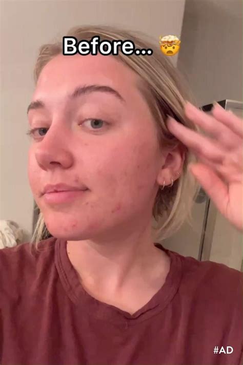 No More Hyperpigmentation Mask Artofit