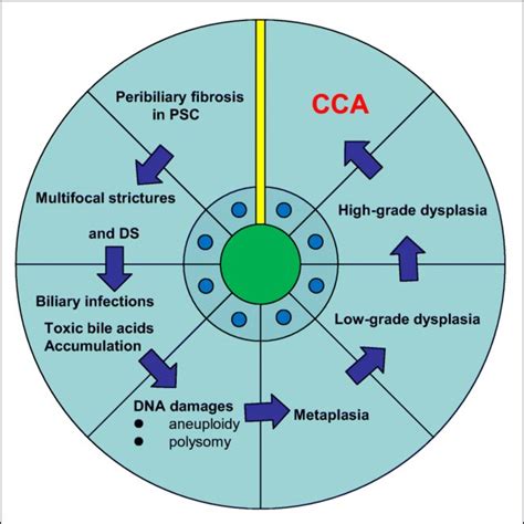 A Concise Algorithm For Demonstrating Cca In Patients With Psc Psc A Concise Algorithm For Demonstrating Cca In Patients With Psc Psc