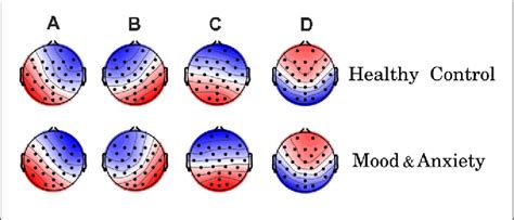 Figure 1 From Eeg Microstates Temporal Dynamics Differentiate
