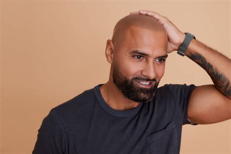 What Creates Pattern Baldness Scalp Micro USA