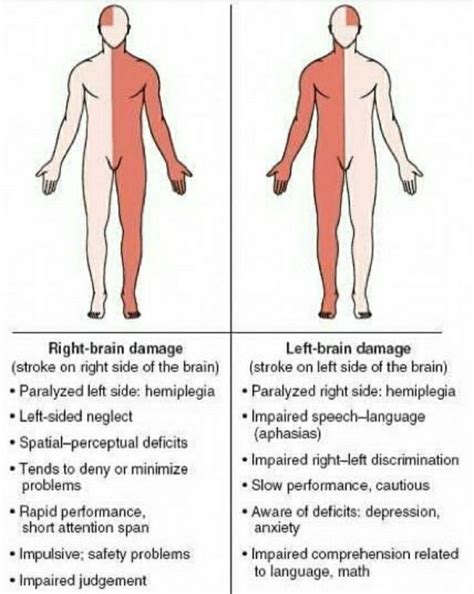 Learn More Stroke Warning Signs And Symptoms Artofit