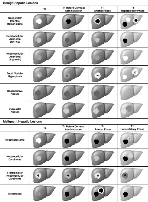 What Is A Mri Liver With Hepatobiliary Contrast At Oliver Packham Blog
