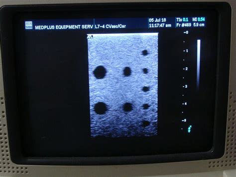 L7 4 Linear Array Transducer Probe For Atl Hdi 5000 Sonoct Ultrasound Diagnostic Ultrasound