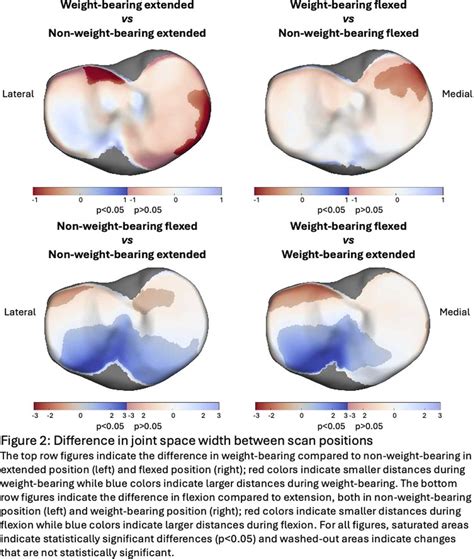 The Influence Of Weight Bearing And Flexion Angle On 3d Joint Space