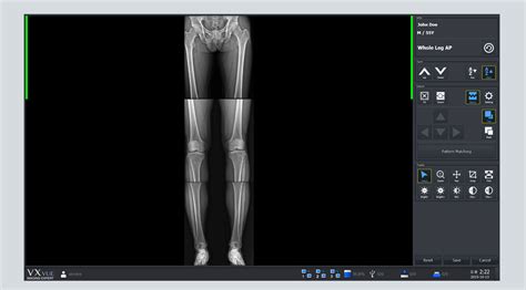 Management Software Viewer Acquisition Radiography Vxvue With
