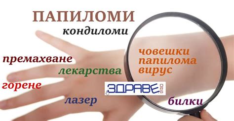 ♠ Какво са папиломи и как изглеждат ♠ Премахване в домашни условия с лекарство против