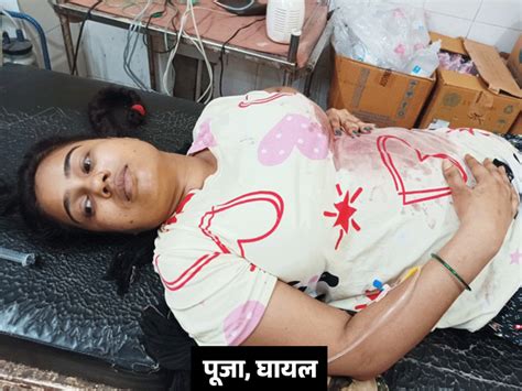 Husband Attacked Wife In Mathura पति ने सॉरी बोलकर पत्नी को बुलाया…फिर चाकू मारी फोन पर बोला