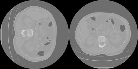 Image Rotating While Converting From Dicom To Nifti · Issue 103