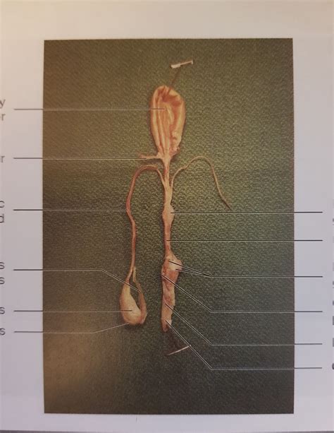 Male Reproductive 2 Diagram Quizlet