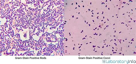 Gram Positive Bacteria Characteristics List Cell Wall Composition