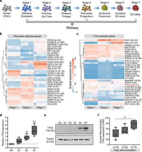 Expression Pattern Of Tyk2 A T1d Candidate Gene During Human