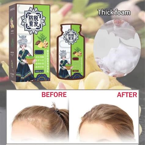 Ginger Plant Extract Anti Hair Loss Hair Shampoo 2024 New Ginger Plant Extract Anti Hair Loss
