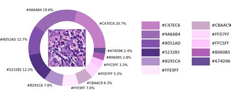 Github Enigarv Breast Cancer Detection Breast Cancer Detection Using