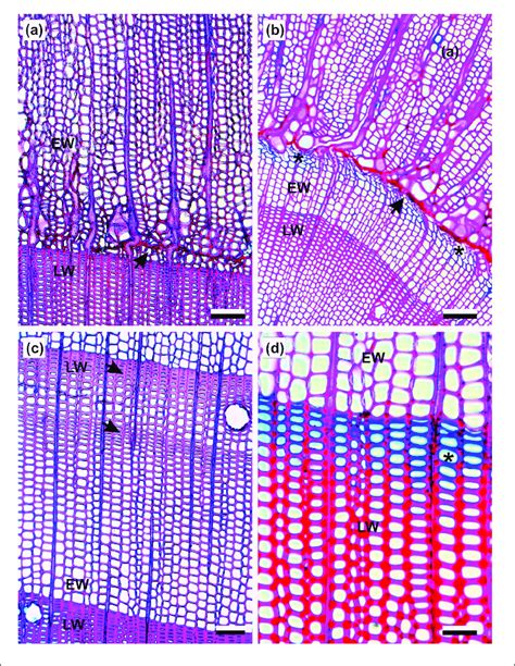 Sections Of Tree Rings Showing Different Xylem Anomalies The Download Scientific Diagram