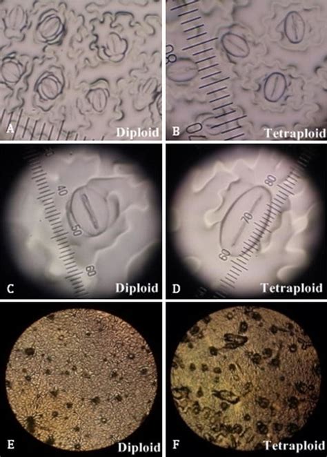 Comparison Of Stomata Density Size And Glandular Hairs Between Diploid Download Scientific