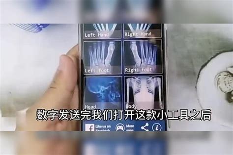 教你开启手机透视功能连手里的骨头都看的一目了然涨知识 透视 骨头 功能