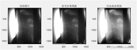 基于matlab的医学图像同态滤波仿真matlab实现同态滤波 Csdn博客 基于matlab的医学图像同态滤波仿真matlab实现同态滤波 Csdn博客