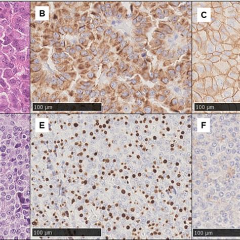 Histological Images Showing Two Example Cases Original Magnification