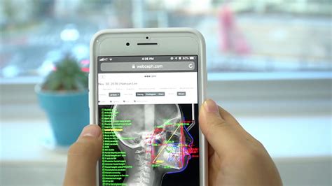 Webceph Ai Cephalometric Analysis Software Youtube