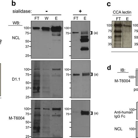 Cca Lectin Chromatography Identifies A 100 Kda Protein In Pre B All