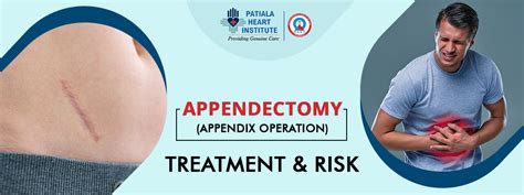 Appendectomy Appendix Operation Treatment And Risk