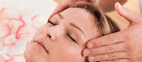 Acupuncture For Headaches